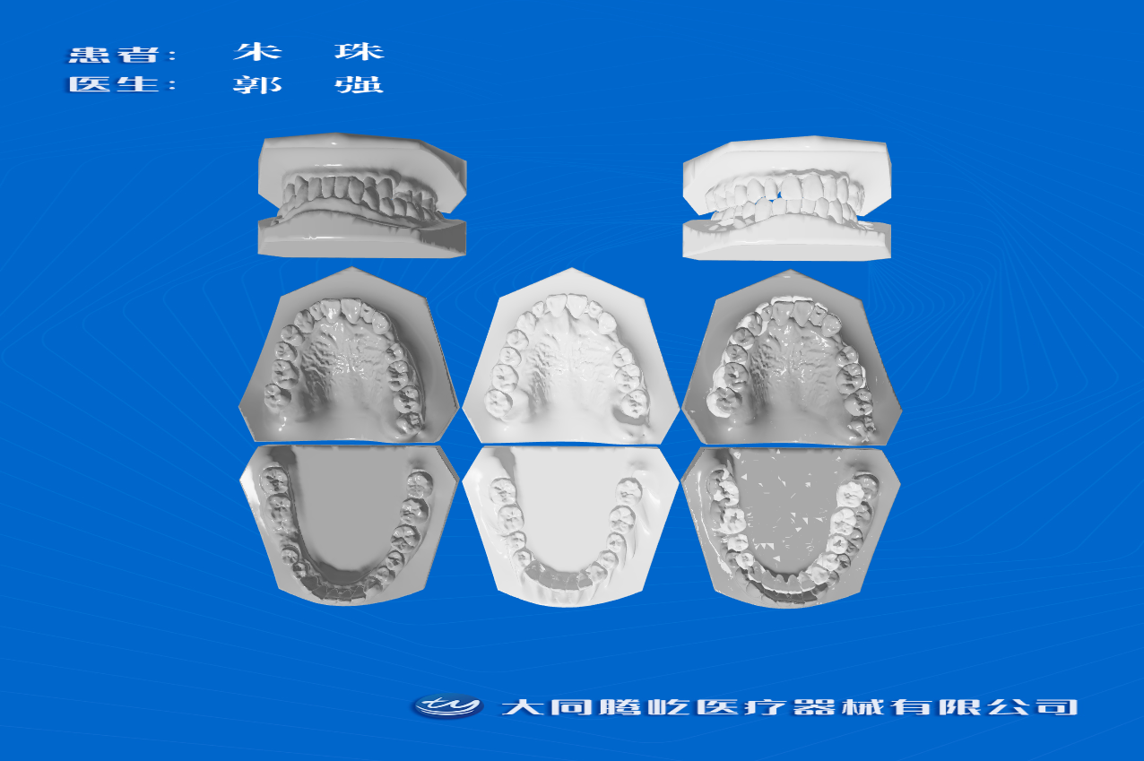朱珠-排牙展示_社区「博维数孪」